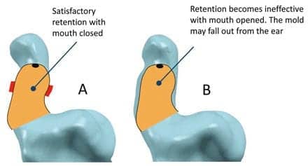 Earmold Retention Issues: Why Does This Earmold Keep Falling Out? | The ...