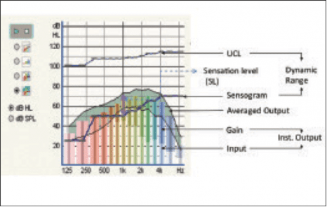 In-situ Thresholds for Hearing Aid Fittings | The Hearing Review