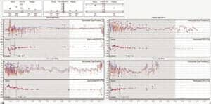 In the Trenches, Part 3: Caloric and Rotational Chair Tests | The ...