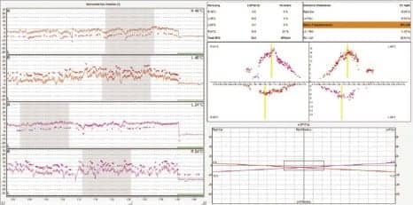 In the Trenches, Part 3: Caloric and Rotational Chair Tests | The ...