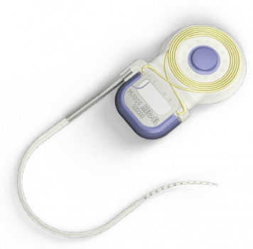 FDA Approves Cochlear Implant for MRI with Internal Magnet in Place