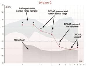 An Overview of OAEs and Normative Data for DPOAEs | The Hearing Review