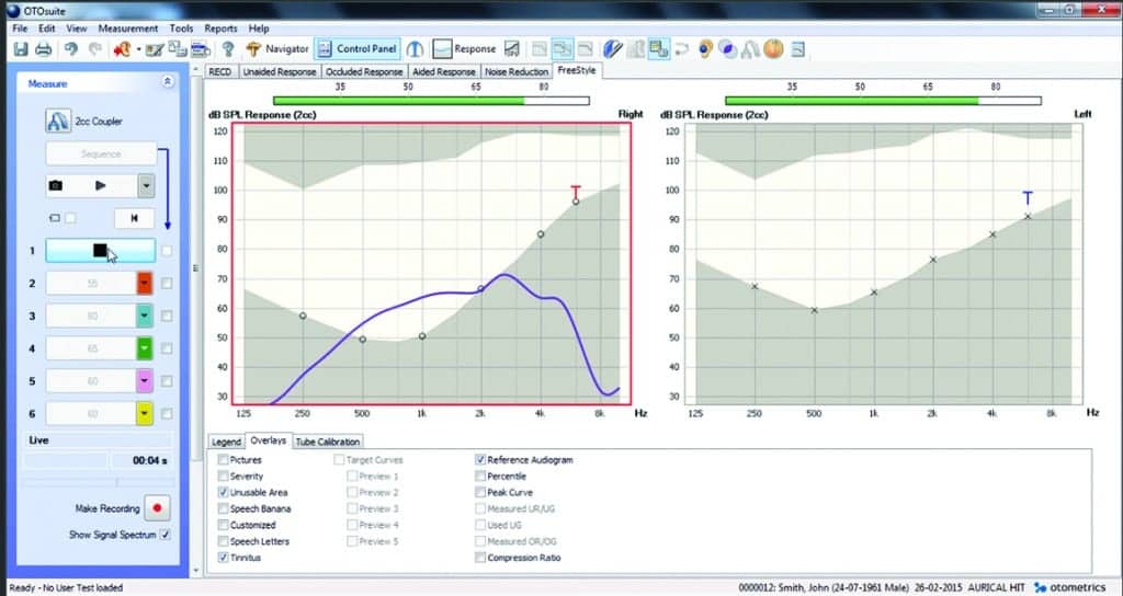 The Tinnitus Toolbox Guide to Support the Full Patient Journey