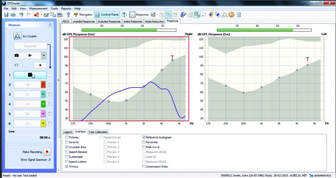 The Tinnitus Toolbox Guide to Support the Full Patient Journey
