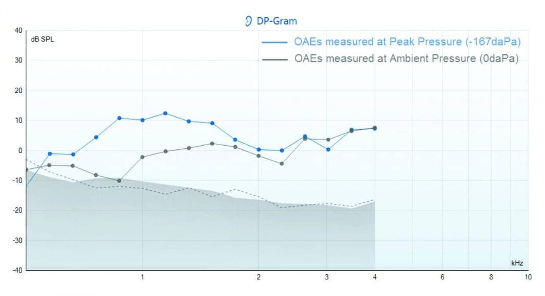 Otoacoustic Emissions and Pressurized OAEs