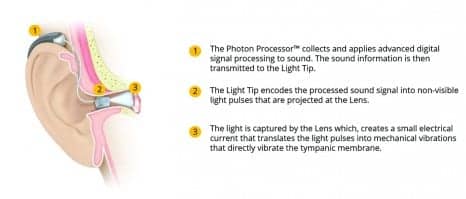 Real-world Bandwidth in Hearing Aids vs Earlens
