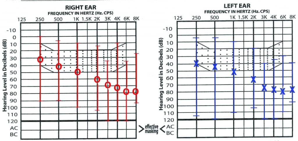 Hearing Aid Programming Practices in Oregon: Fitting Errors and Real ...