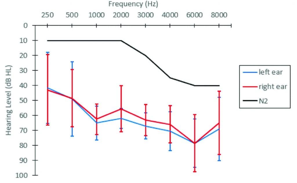 An Integrated REM System with Proven Accuracy and Reliability | The ...
