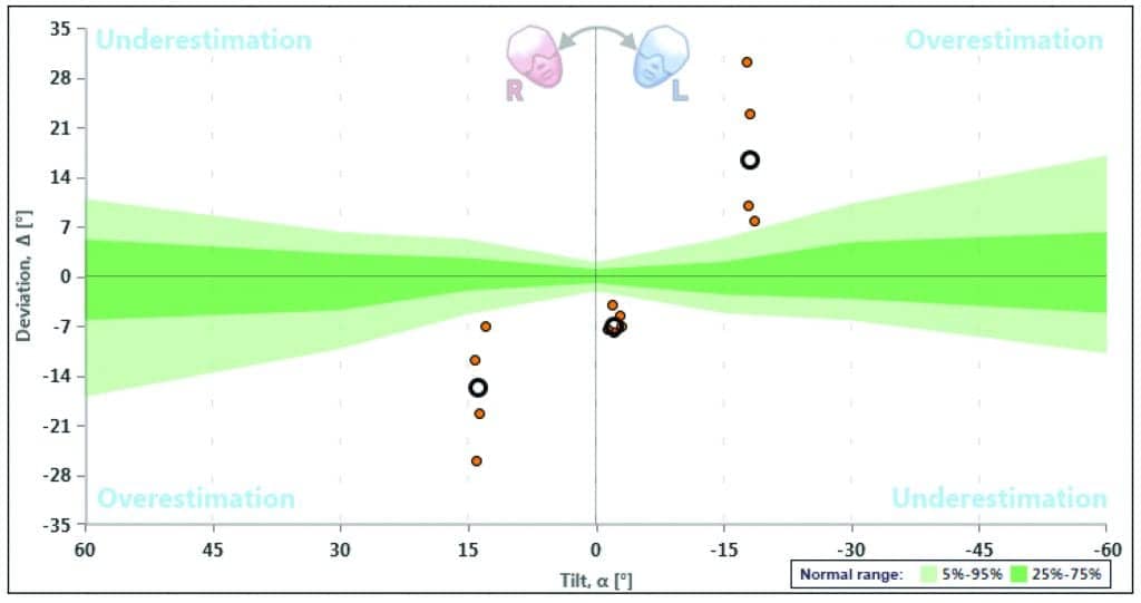 Subjective Visual Vertical (SVV) and the Dizzy Patient | The Hearing Review