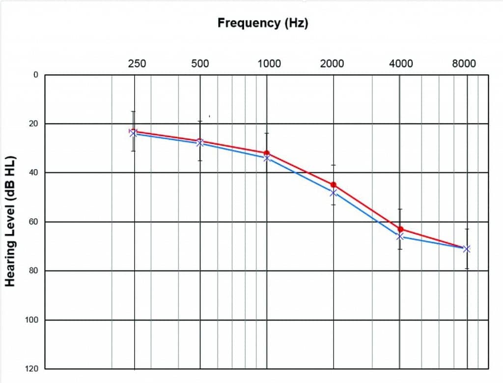 Field Trial Tests the Sound Quality of ReSound LiNX 3D | The Hearing Review