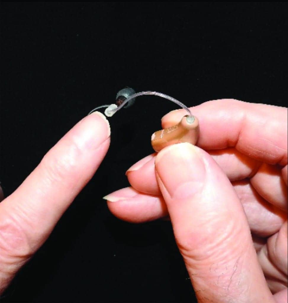 A Simple and Expedient Method to Facilitate Receiver-in-Canal (RIC) Non ...