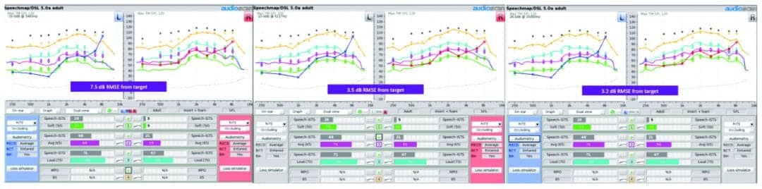 A Comparison of Automated Real-Ear and Traditional Hearing Aid Fitting ...