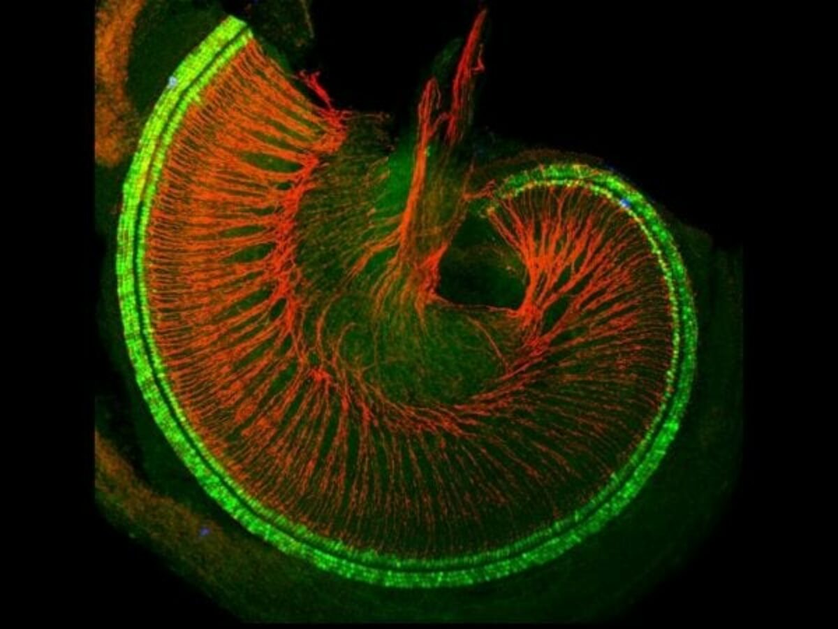 Hair Cells Under A Microscope