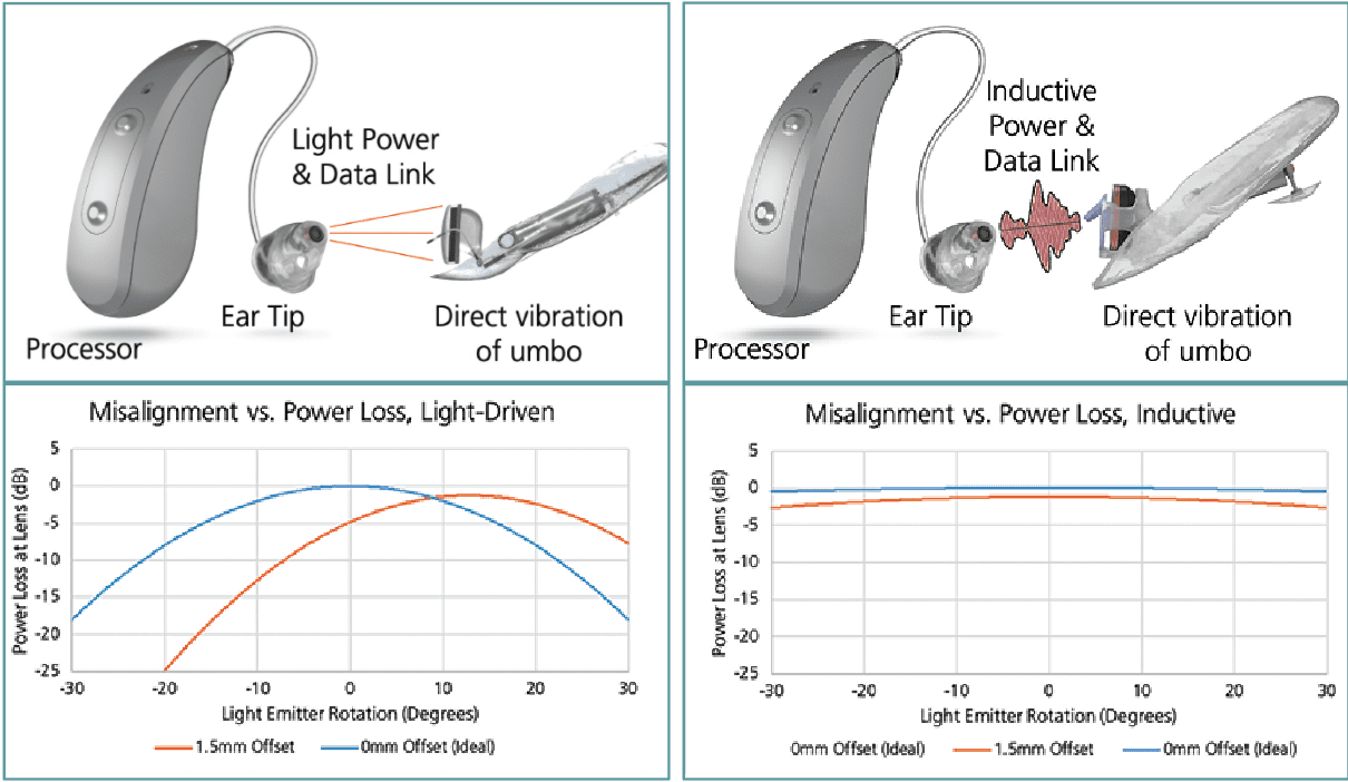 Earlens Contact Hearing Solution Introduced with Inductive Coupling vs ...