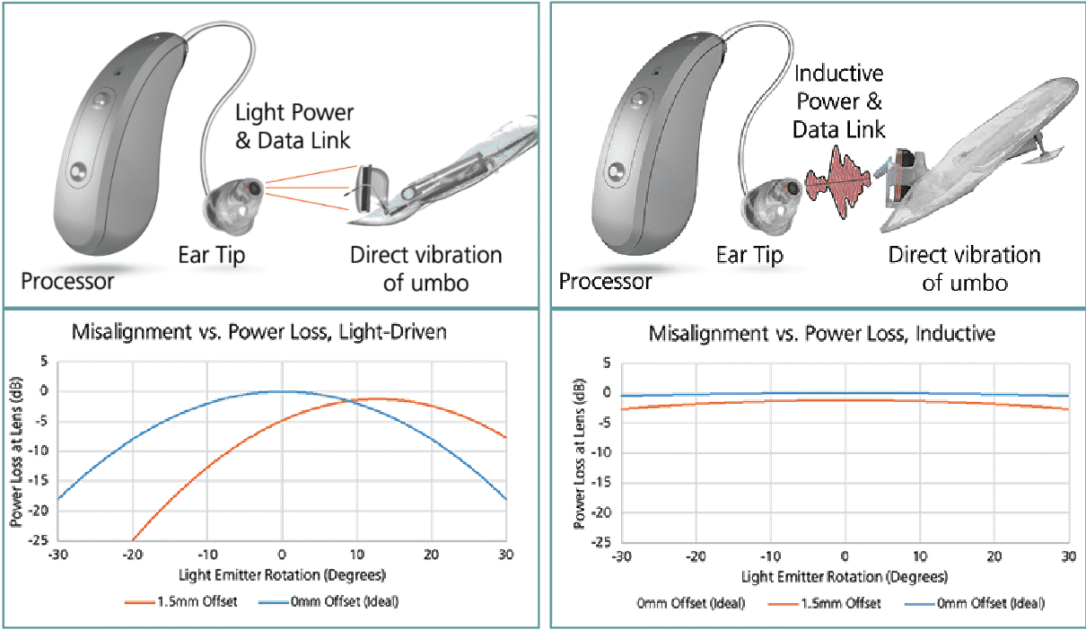 Earlens Contact Hearing Solution Introduced with Inductive Coupling vs ...