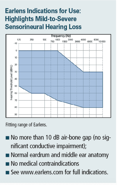 Earlens Contact Hearing Solution Introduced with Inductive Coupling vs ...