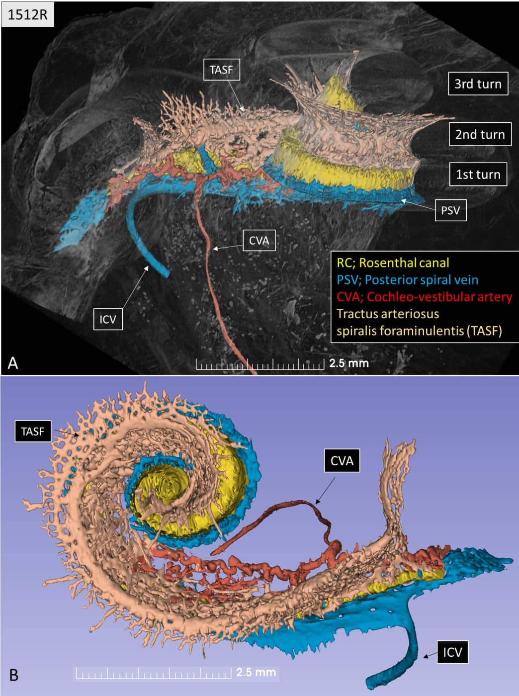 Researchers Map Blood Vessels of Inner Ear | The Hearing Review