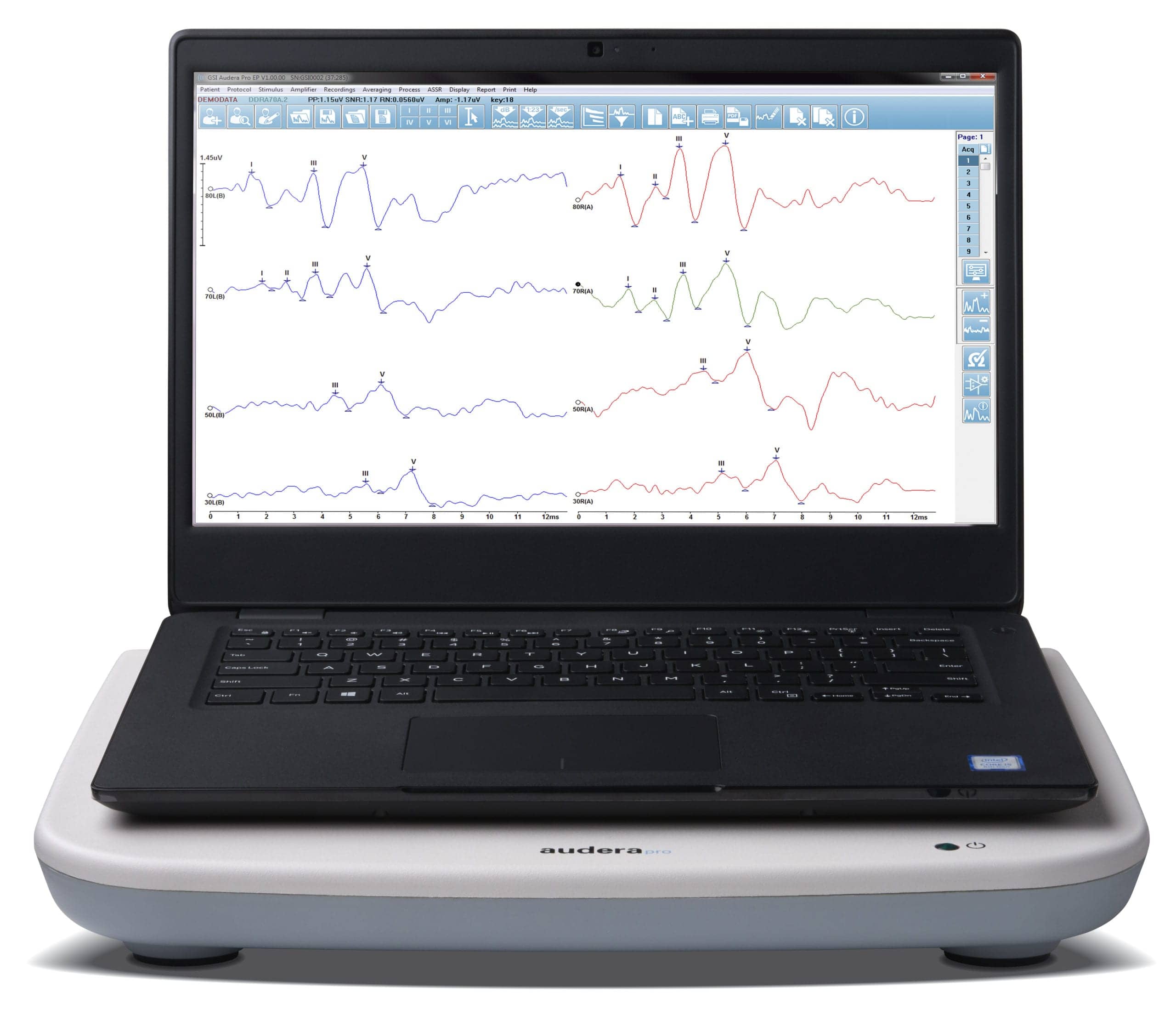 Grason-Stadler Releases GSI Audera Pro Clinical EP/OAE Device | The ...