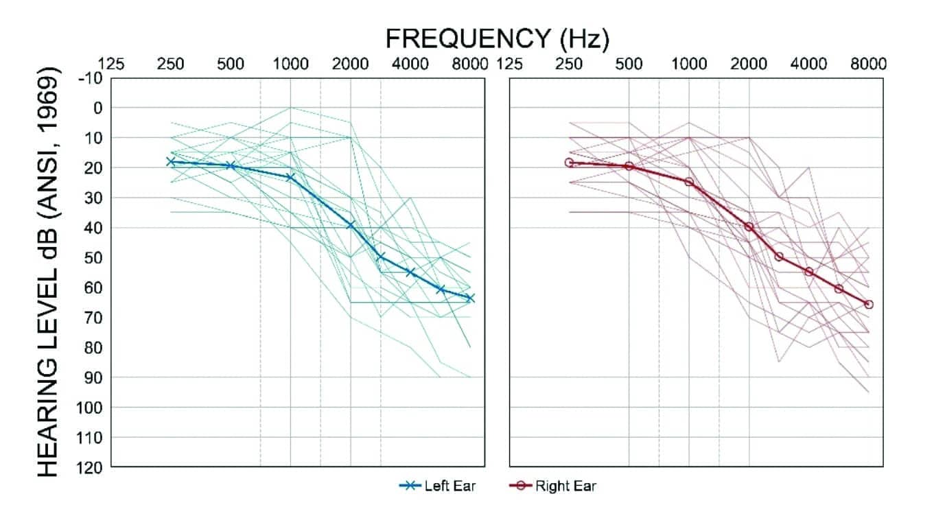 Efficacy of Directional Microphones in Open Fittings Under Realistic ...