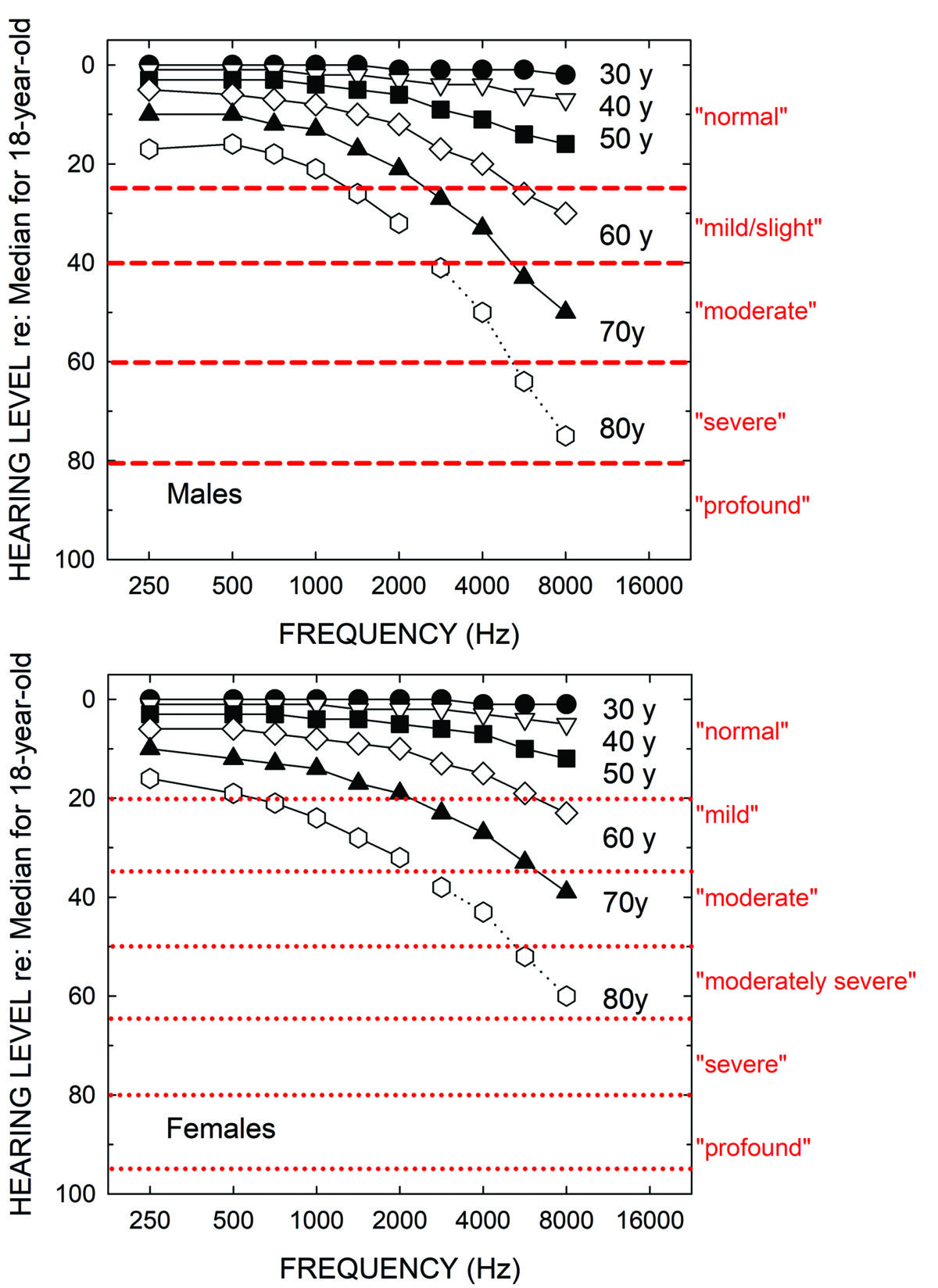 What Is Normal Hearing | The Hearing Review