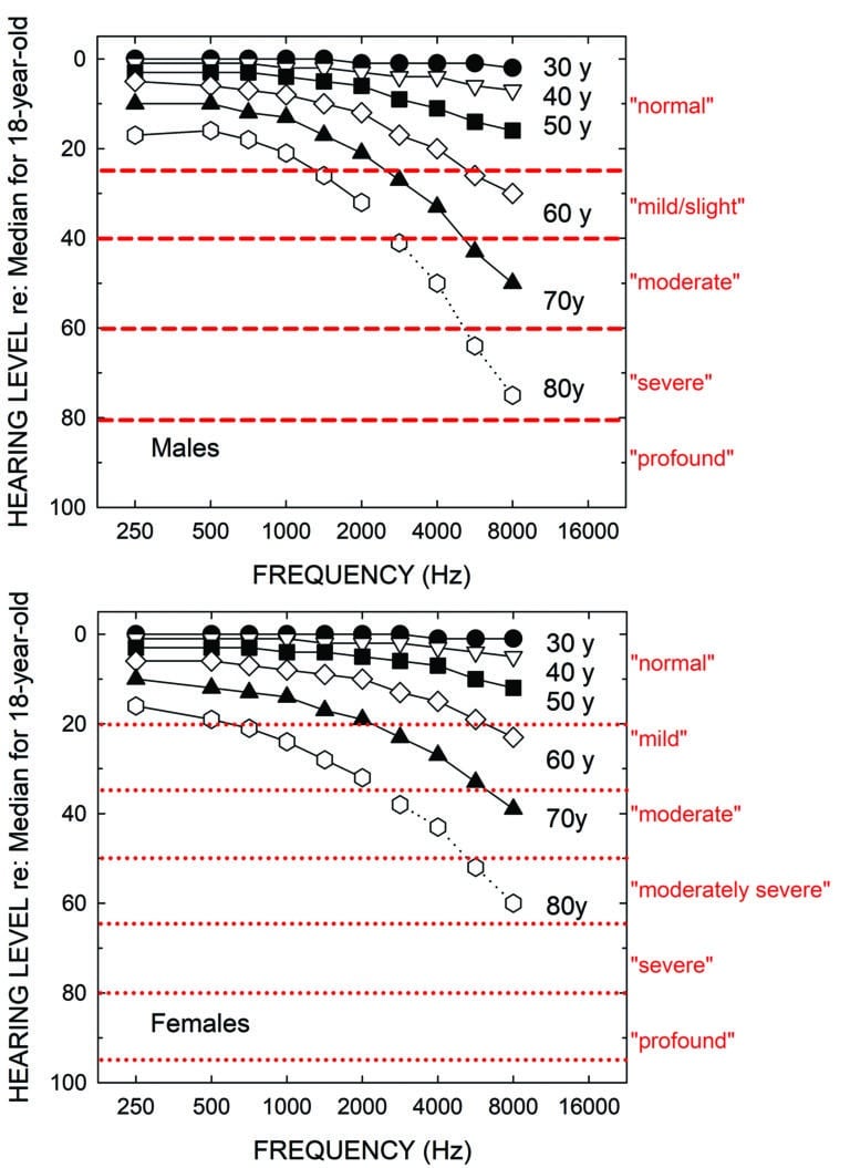 What Is Normal Hearing | The Hearing Review