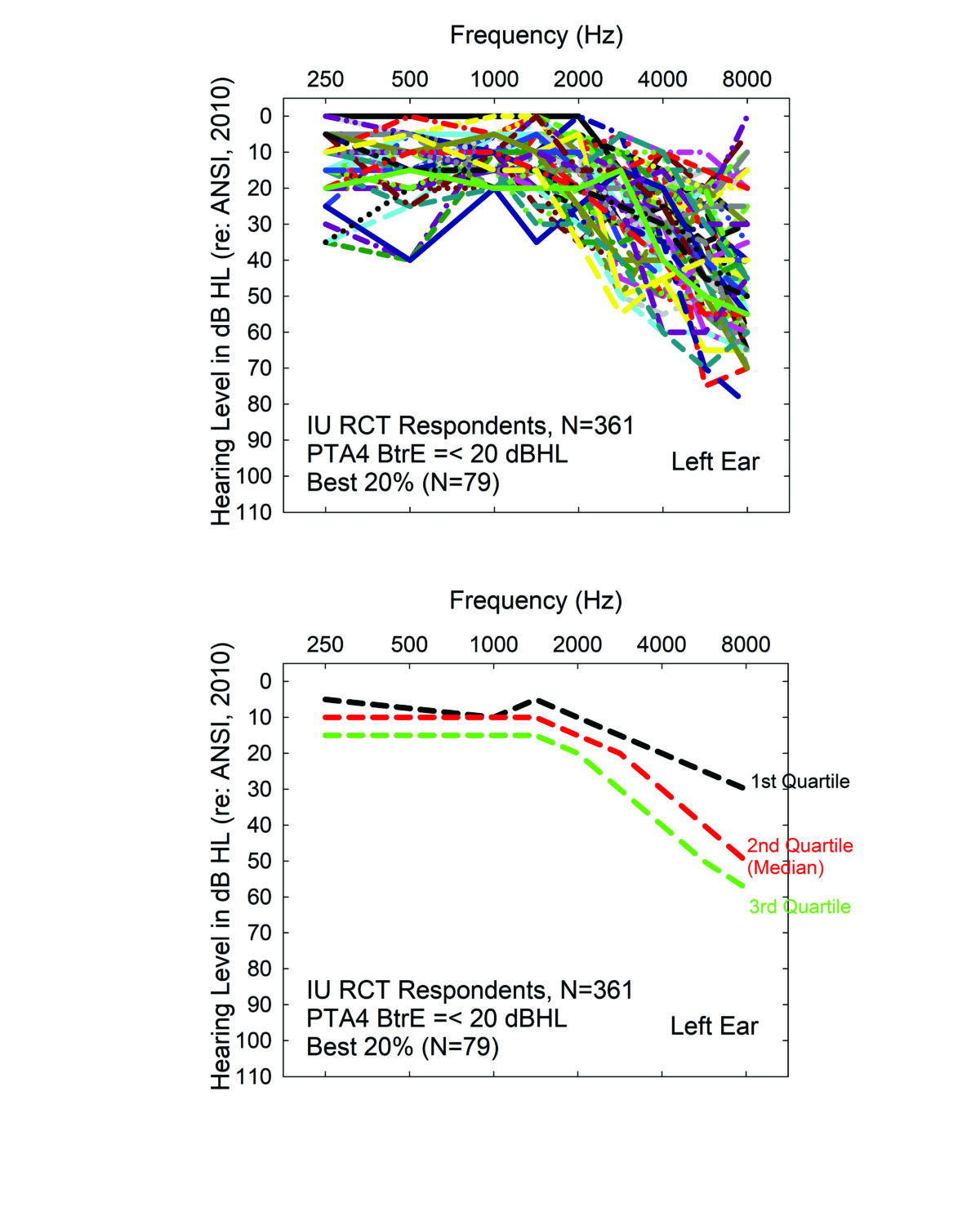 What Is Normal Hearing | The Hearing Review