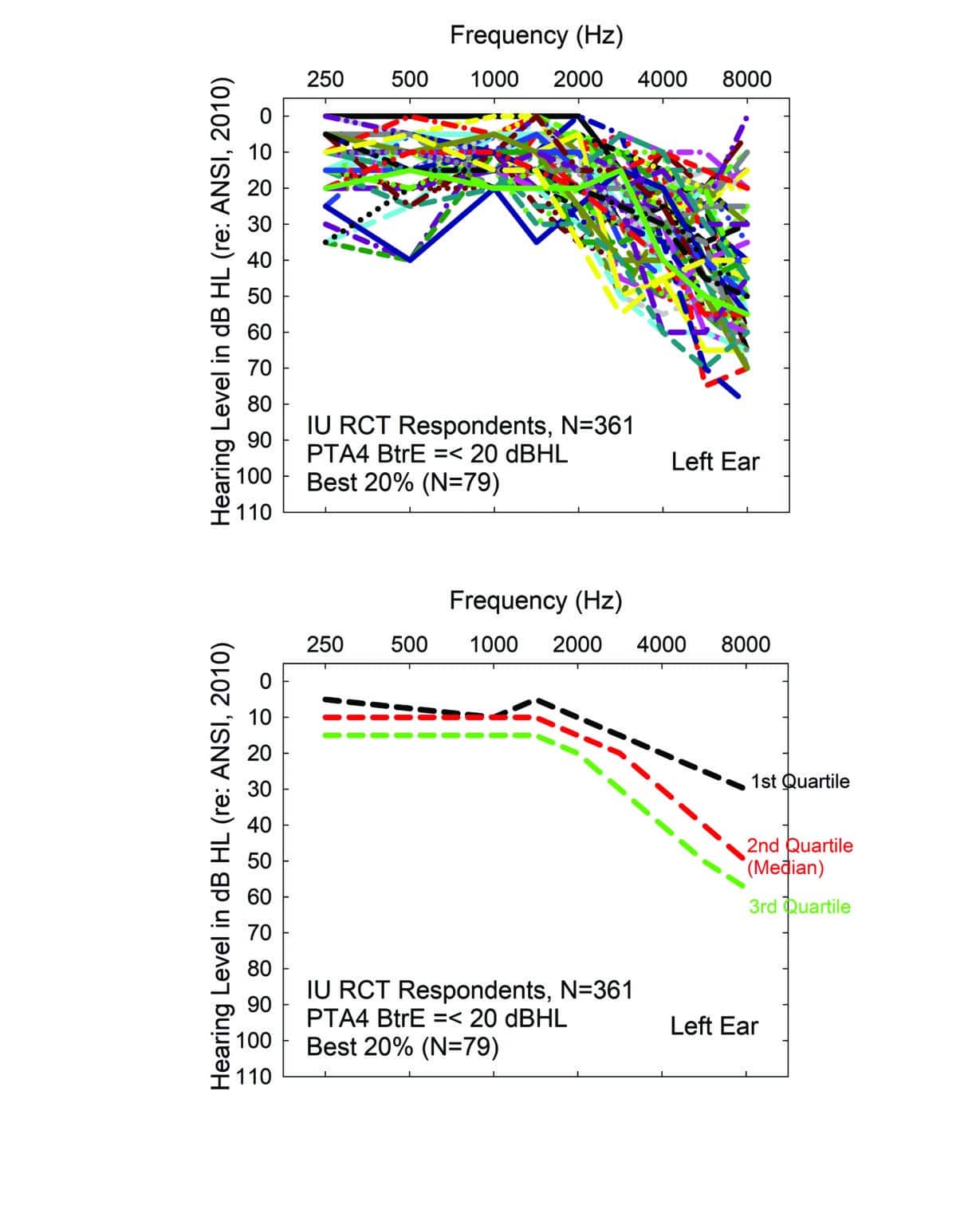What Is Normal Hearing | The Hearing Review
