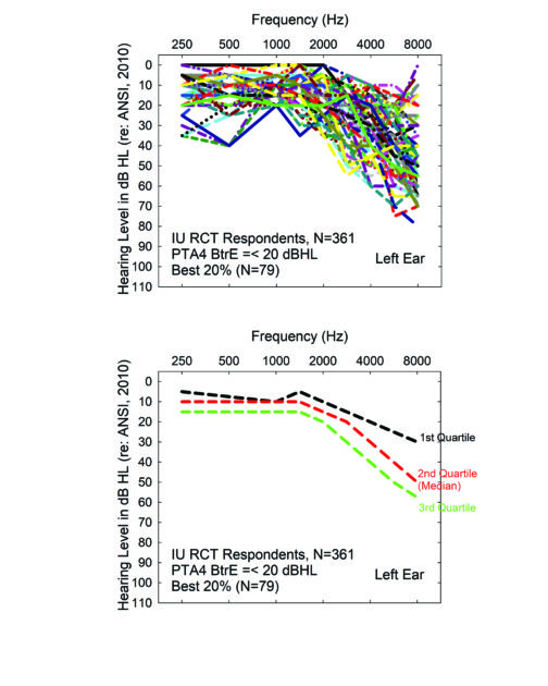 What Is Normal Hearing | The Hearing Review