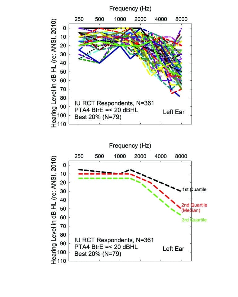 What Is Normal Hearing | The Hearing Review
