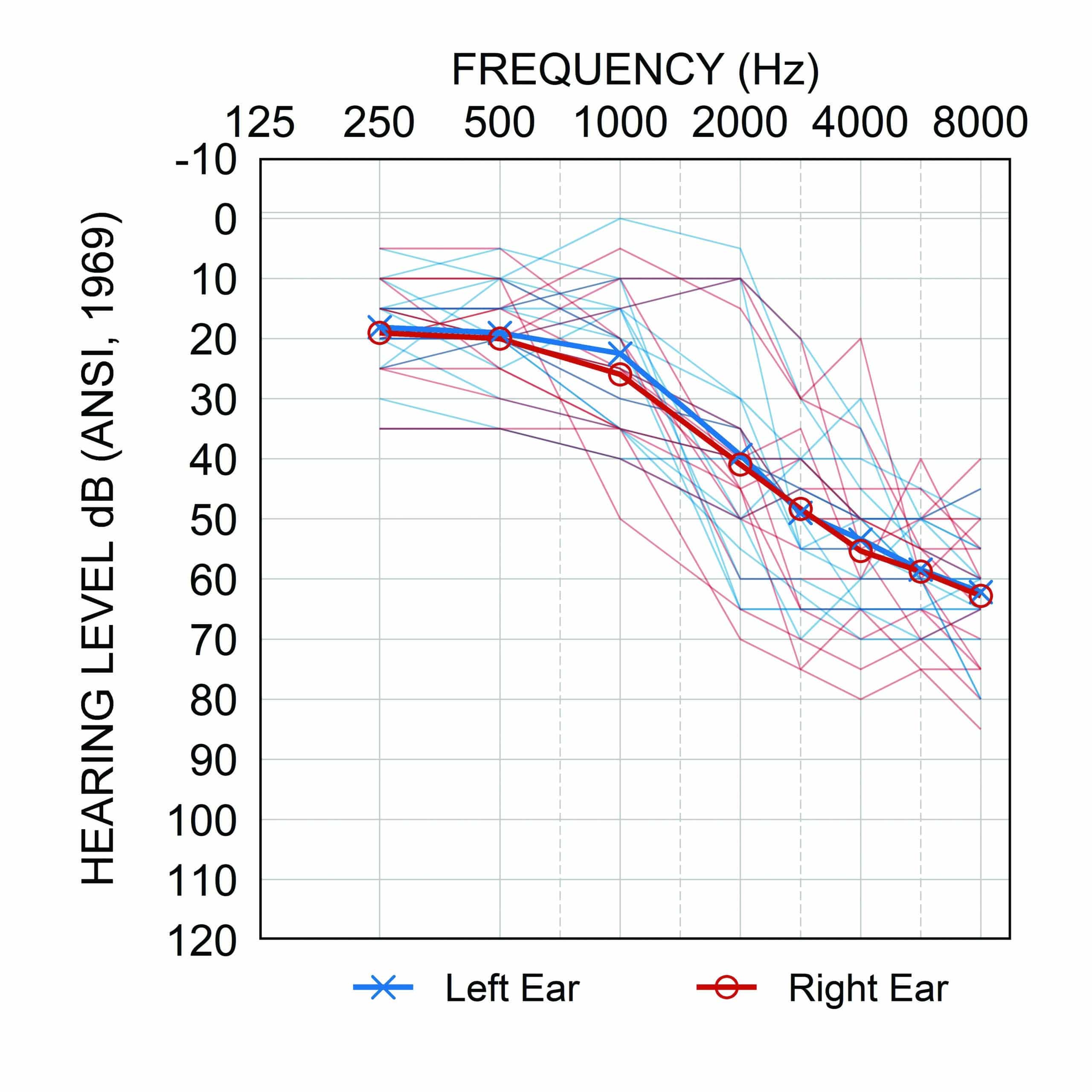 Neural Encoding of the Stimulus Envelope Facilitated by Widex ZeroDelay ...