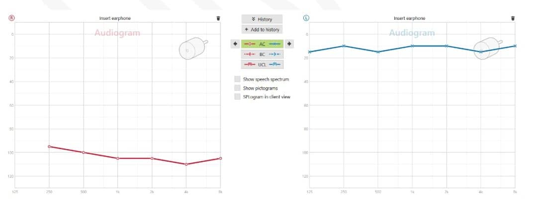 Optimizing CROS/BiCROS Benefit Using Probe Microphone Verification and ...