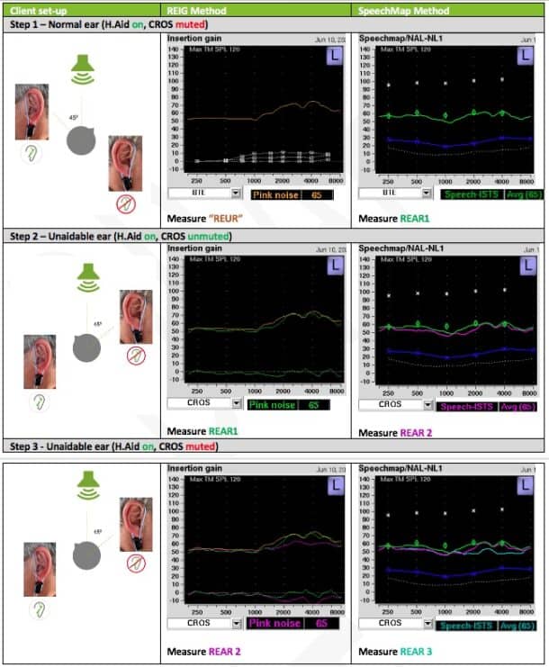 Optimizing CROS/BiCROS Benefit Using Probe Microphone Verification and ...