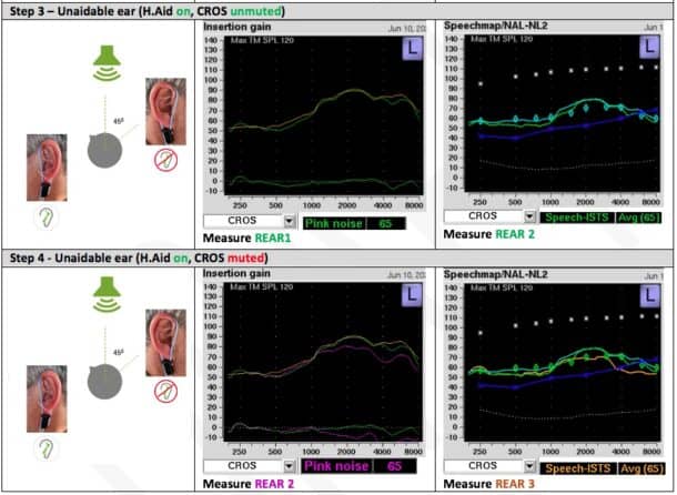 Optimizing CROS/BiCROS Benefit Using Probe Microphone Verification and ...