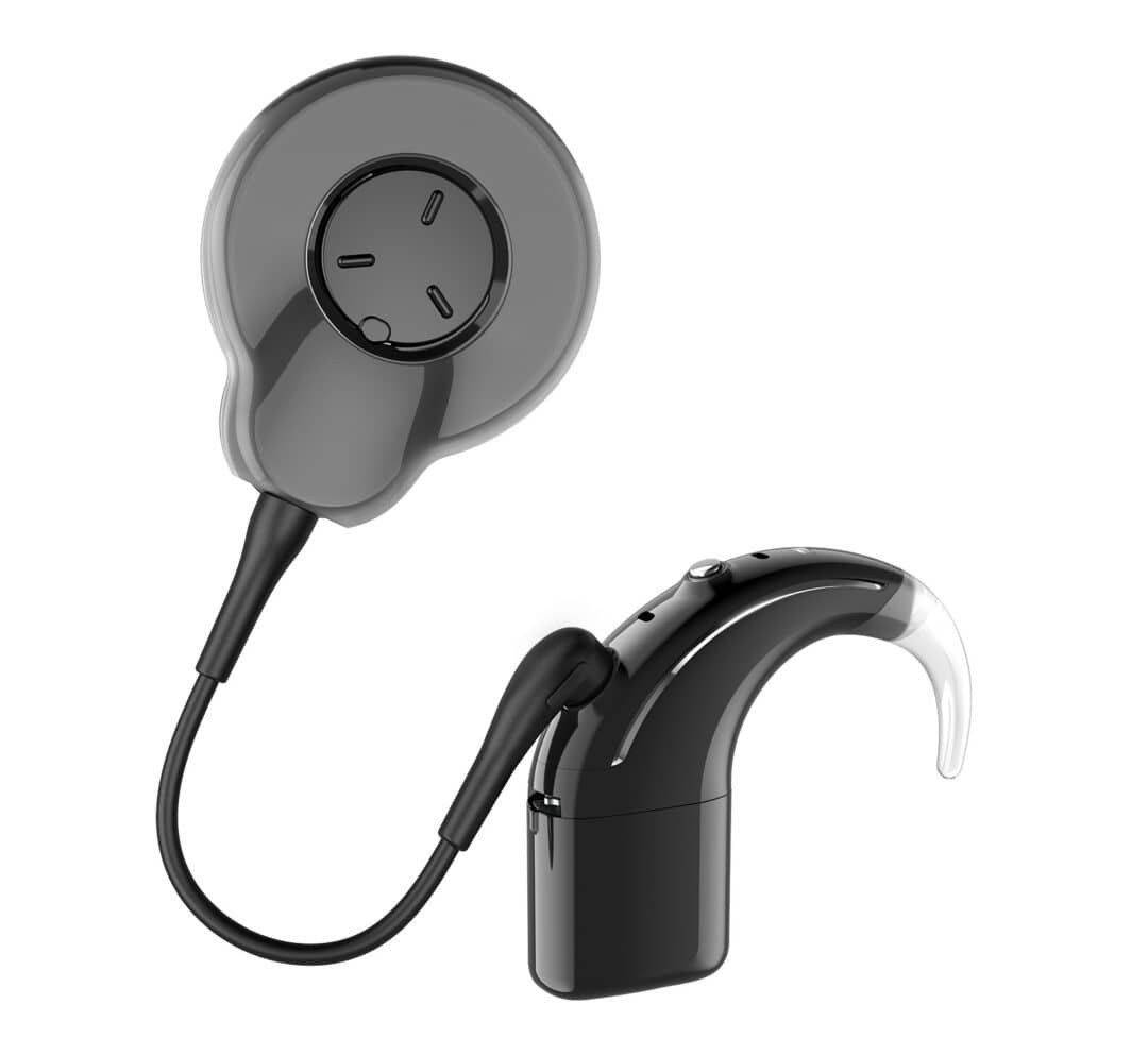 Cochlear Nucleus 8 Sound Processor Receives FDA Approval | The Hearing ...