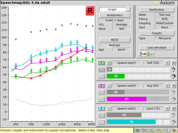 An Affordable Way To Take Control Of The Fitting Process | The Hearing Review