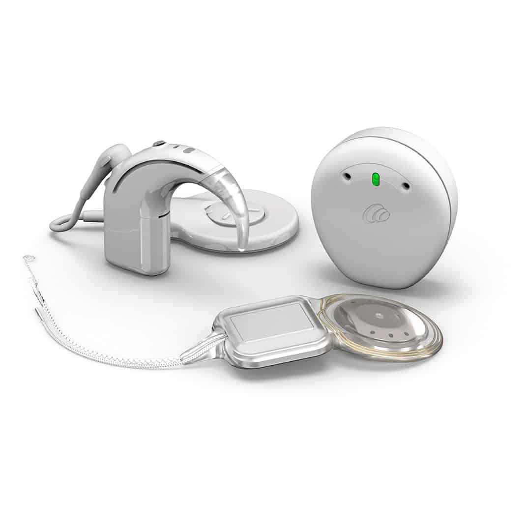 Cochlear Launches Nucleus Nexa Smart Cochlear Implant System | The Hearing Review
