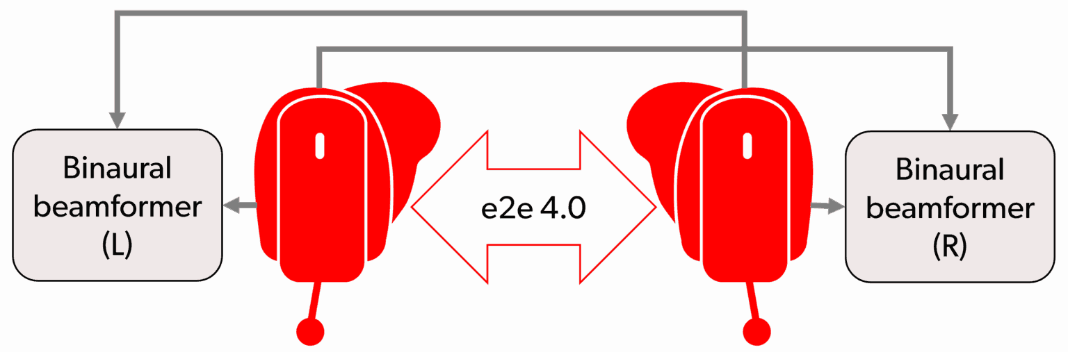 Directionality in Single-Microphone Hearing Aids: Speech Enhancement ...